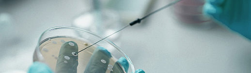 Enhancing Flavor and Functionality – The Science Behind Enzyme Modified ...